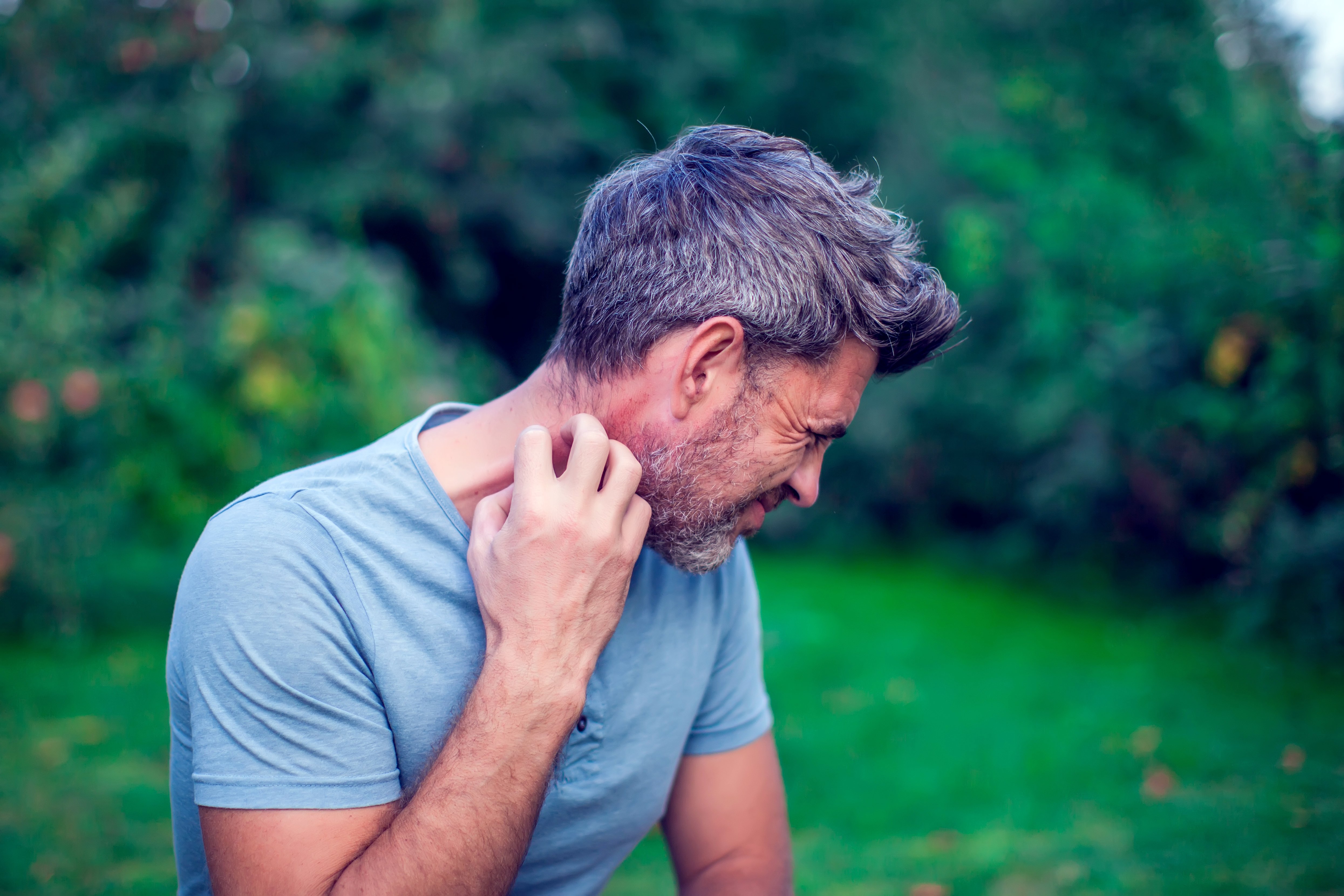How To Sidestep A Summer Heat Rash Indigo